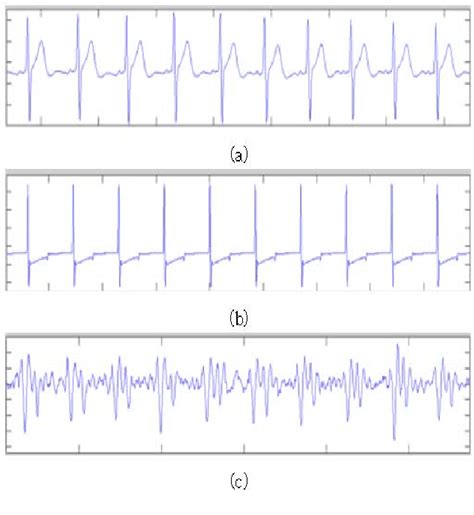 Figure 1 From Smart Chair Based On Multi Heart Rate Detection System Semantic Scholar