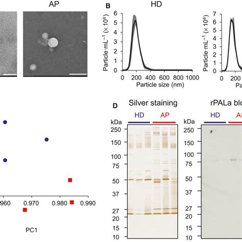 glycan profiling of evs derived from sera of hds and aps a