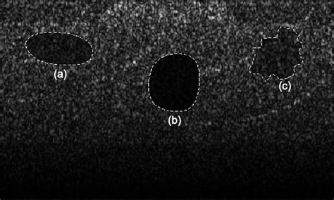 Example Of A Simulated Bus Image That Contains Three Typical Breast Download Scientific Diagram