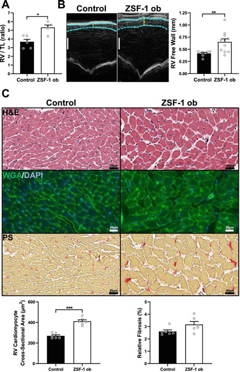 Zsf‐1 Obese Rats Exhibit Right Ventricular Hypertrophy A Gravimetric