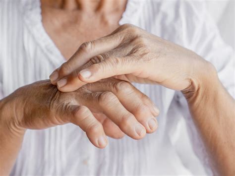 Nice Gout Guidelines For Gps June 2022