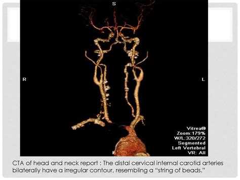 By Stephanie Sadek Baker College Of Auburn Hills Ppt Download
