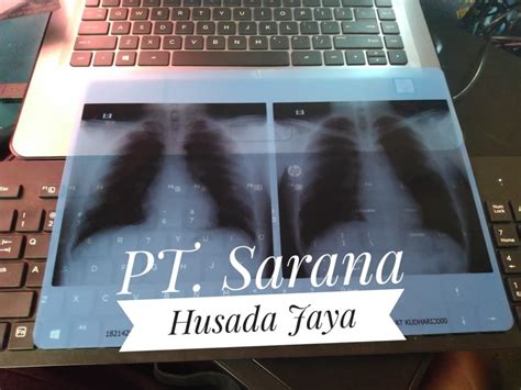 Sewa BUS RONTGEN MCU X RAY On Site Seluruh Indonesia ALAT X RAY PAKET RADIOLOGI KACA PB