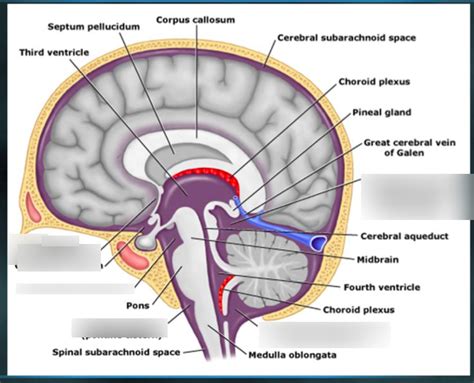 Quadrigeminal Cistern Lipoma Mimicking Intracranial Air