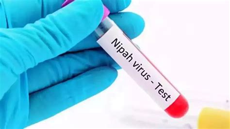 Nipah Virus നിപ ലക്ഷണങ്ങള്‍ വരാതിരിയ്ക്കാന്‍ Signs And