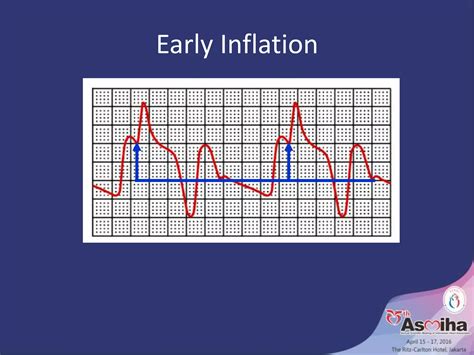 Iabp Principle Hemodynamic Timing Weaning 2016 Background Asmiha Isman Edit Pptx