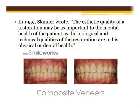 Composite Resins Ppt