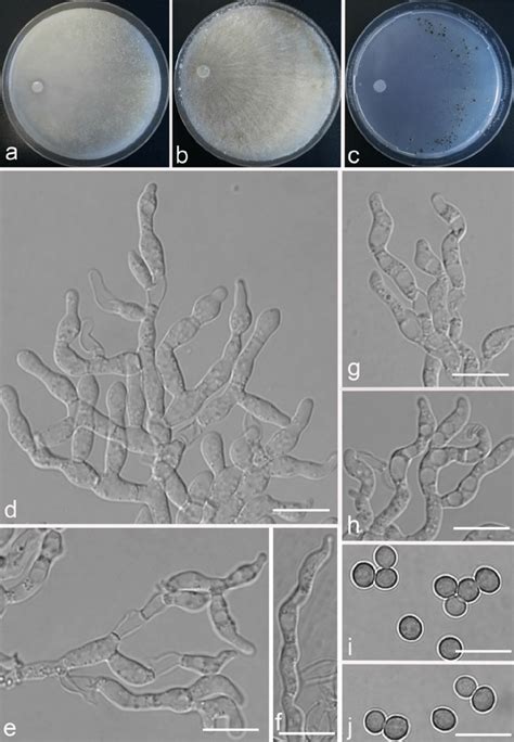Trichoderma Asymmetricum Ymf 104618 A C Cultures After 7 D At 25