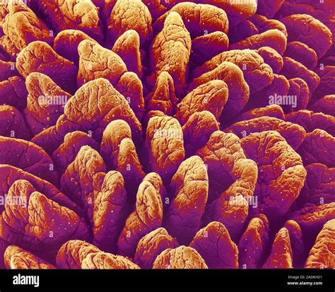 Small Intestine Villi Coloured Scanning Electron Micrograph Sem Of Villi Folds On The