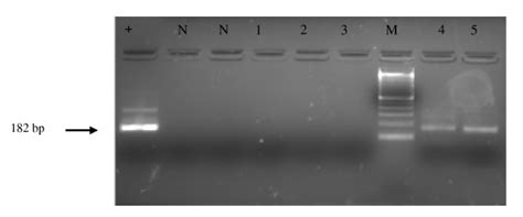 nested pcr analysis of viral dna from representative colorectal cancer