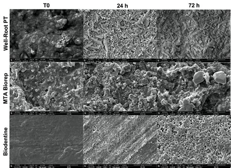 Scanning Electron Microscope Images 5000× Magnification Demonstrate