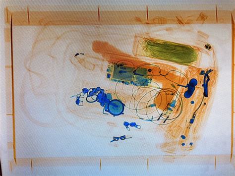 X Ray Photo Of Stock Image Image Of Check Security 156591273