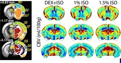 저산소 상태 활용한 뇌 혈류 측정 새 방법 제시