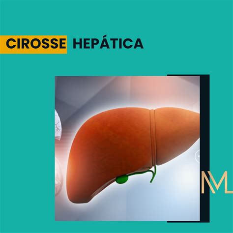 Cirrose HepÁtica Inml