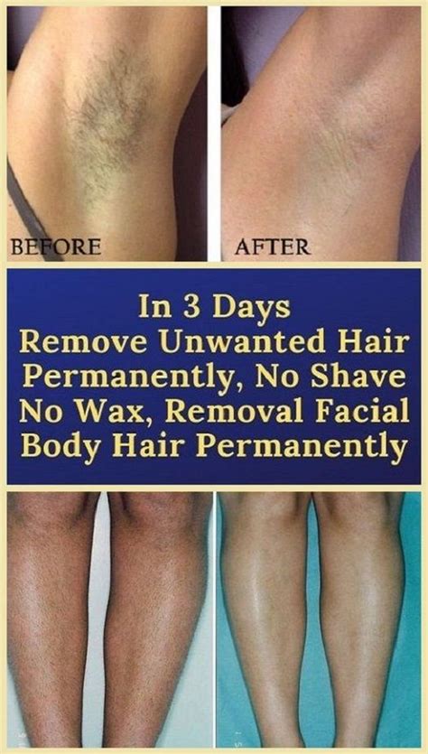 Best Way To Remove Unwanted Hair Permanently Alum Powder Hair Removal