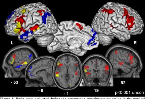 Figure 1 From The Neural Substrates Of Musical Memory Revealed By Fmri And Two Semantic Tasks