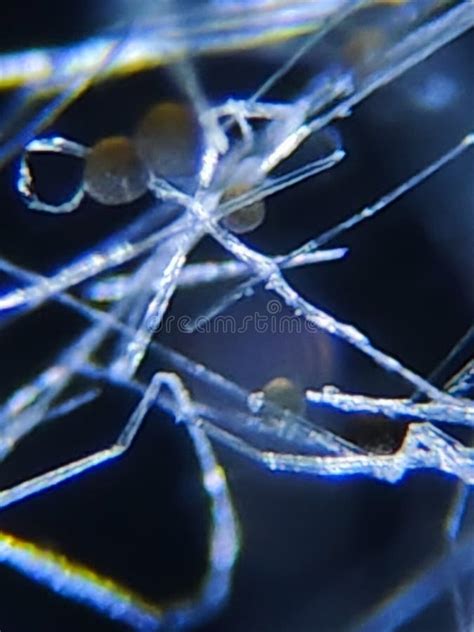 Aspergillus Genus Mold Under The Microscope Stock Image Image Of