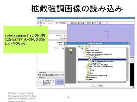 Dti Diffusion Sensitizing Gradient Diffusion Sensitizing Gradient Planning