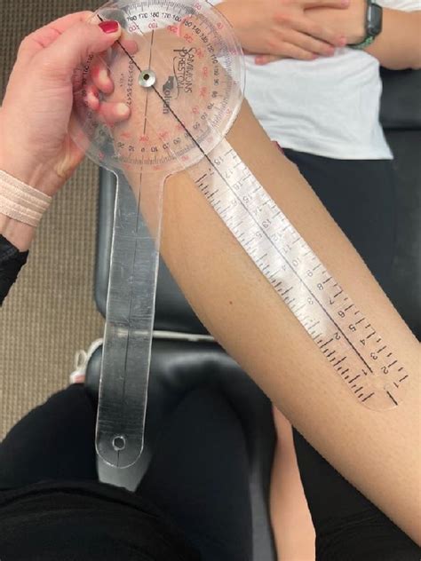 Figure 2 From An Anterior Cruciate Ligament ACL Injury Risk Screening And Reduction Program