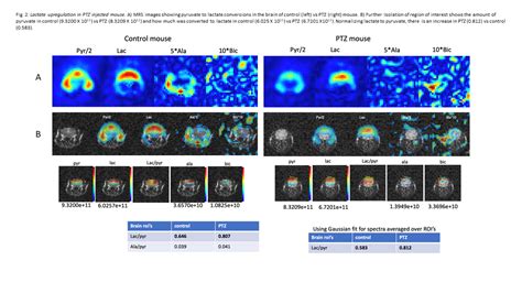 Mr Spectroscopy Of Hyperpolarized [1 13c] Pyruvate As A Novel Imaging Tool For Epilepsy