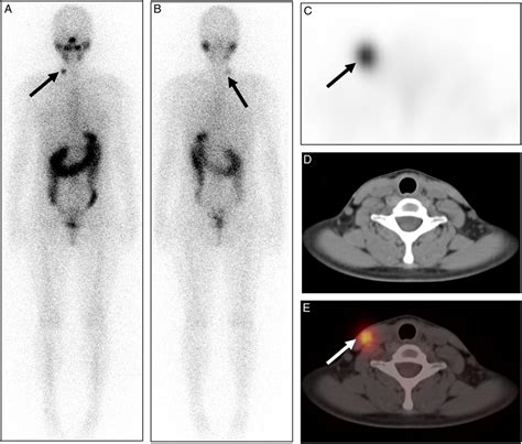 Clinical Nuclear Medicine