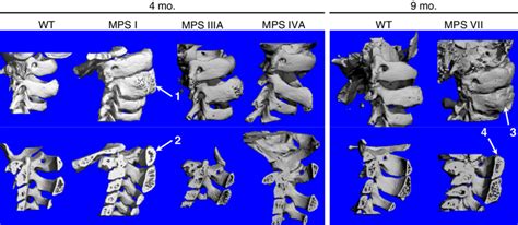 Three Dimensional Micro Ct Reconstructions Of Cervical Vertebrae 1 And