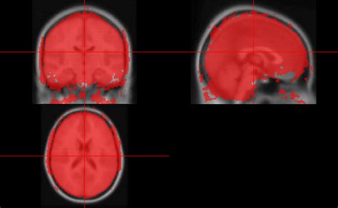 fmri preprocessing using spm 12 spm12r
