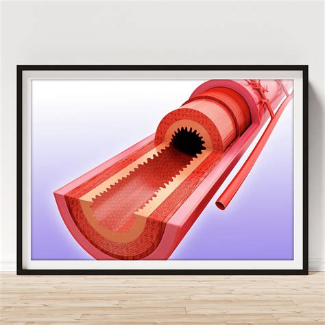 Small Intestine Wall Art Print By Science Photo Library Science Photo