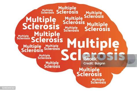 다발성 경화증 개념 예술 인간의 두뇌 실루엣입니다 텍스트 비문이 있는 배경 배너 카드 포스터용 템플릿입니다 벡터 Eps10 그림입니다 다발성 경화증에 대한 스톡 벡터 아트