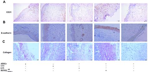 Runx2 Improves Neovascularization And Re Epithelialization Of Burn Skin Download Scientific
