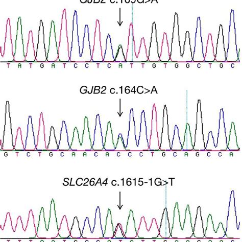 Chromatograms Of Three Mutations Identified By Whole Coding Regions