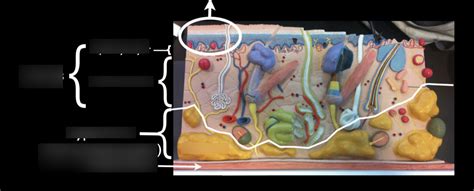 Dermis Vs Hypodermic Side View Diagram Quizlet