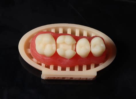 Jual Posterior Class 2 Mod With Gum Edm X Griya Rr Kota Surabaya