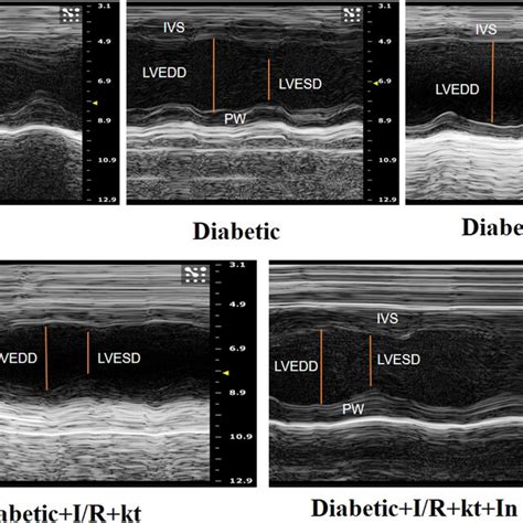 An Illustration Of An M Mode Echocardiogram Of The Left Ventricle Download Scientific Diagram