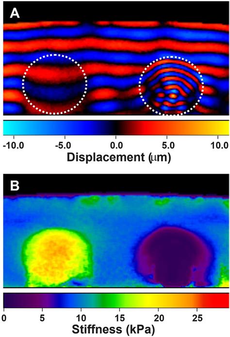 Magnetic Resonance Elastography From Invention To Standard Of Care Pmc