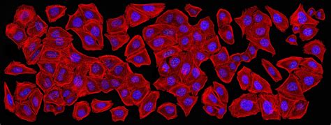 Cytoskeleton Red Science Art Print On Paper Canvas Acrylic