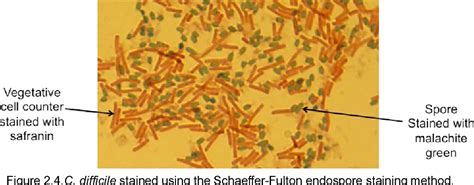 Clostridium Difficile Spore Stain