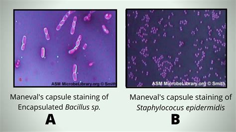 Mavevals Capsule Staining Method Archives Biology Notes Online