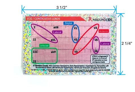 Glitter Sticker Ekg Stemi Reference Tool Rn Card Etsy