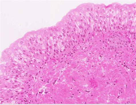 Biol 221 Exam 4 Histology Flashcards Quizlet