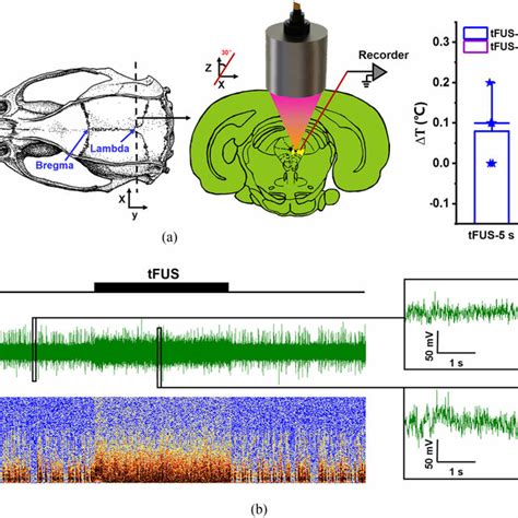 A The Localization Of The Electrode And Tfus Stimulation Area In