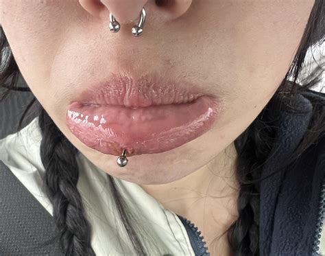 Vertical Labret Piercing Infection Mat Pierced This Vertical Labret
