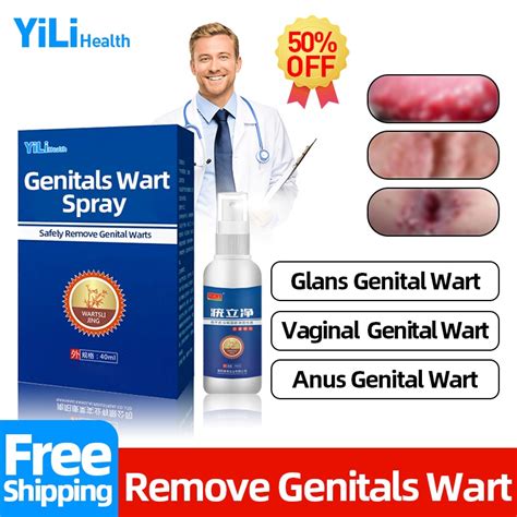 Genital Warts Treatments Genital Wart Treatment Online Xvgxuz