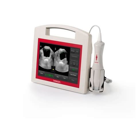 Vitascan Pd Portable Ultrasound Bladder Scanner Console Pvr With Printer And Probe Vitascan V2