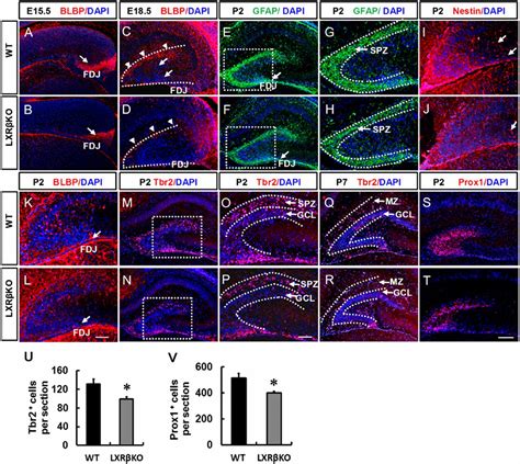 Hilus Dentate Gyrus Mouse