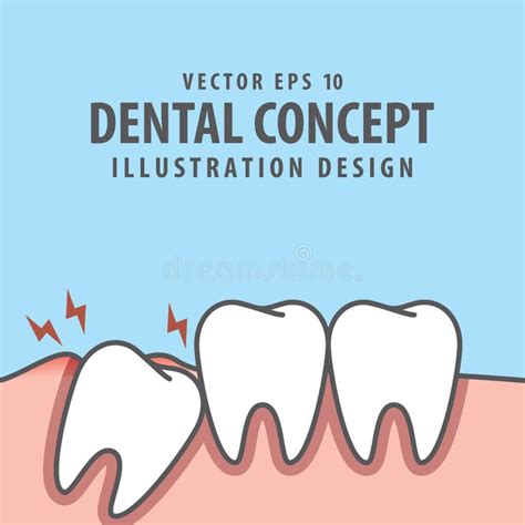 Impacted Tooth Stock Illustrations 223 Impacted Tooth Stock