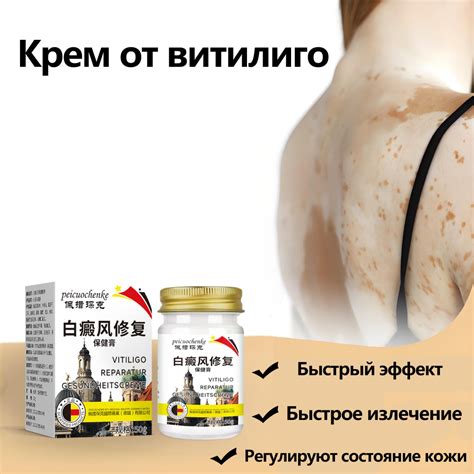 крем от пигментации 50 г восстановление от витилиго уход за кожей быстрое устранение белых пятен