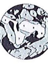 Hip Anatomy Diagram Quizlet