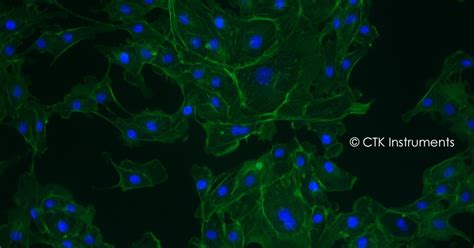 Microscope World Blog Fluorescence Microscopy Camera