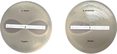 Ampc Mic Test Strip Detection Of Ampc Producing Gnb By The Combined